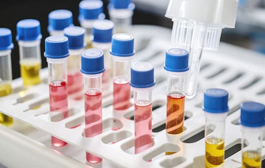 Types of in Vitro Diagnostics: Clearing up the Confusion | Clinical ...